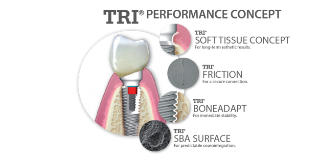 Narrow Implant Machined, Ø 3.3mm,with Surgical Cover-Screw by TRI Swis ...